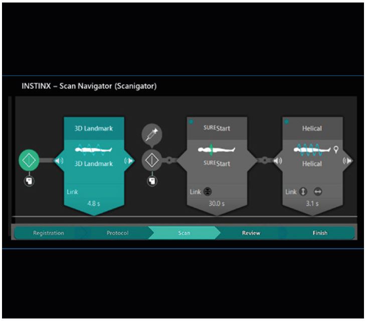 Представляємо нову систему КТ Aquilion Serve